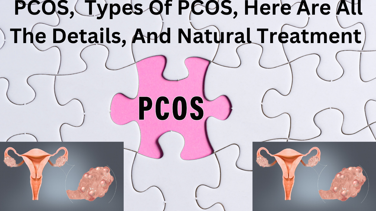 PCOS, Types Of PCOS, Here Are All The Details, And Natural Treatment ...